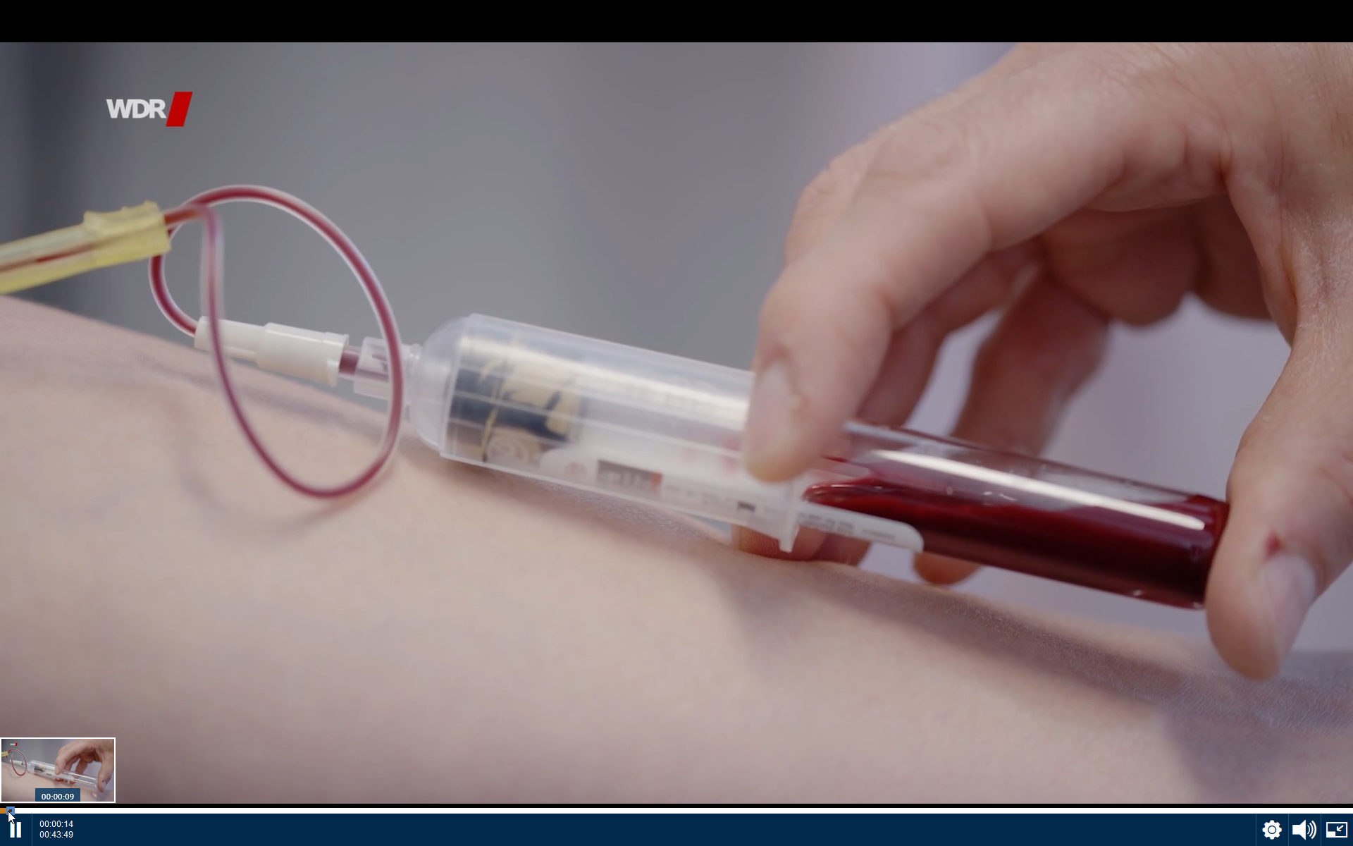 Der Bluttest – Entscheidungsdrama vor der Geburt - Lebenshilfe ...